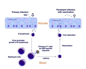 Hairy Leukoplakia - Pictures, Treatment, Diagnosis, Features