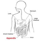 What Side is Your Appendix on?